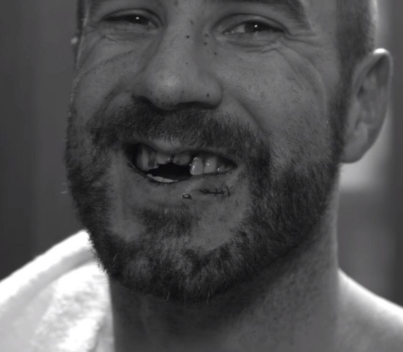 6 WWE Superstars who've had their teeth knocked out in the ring