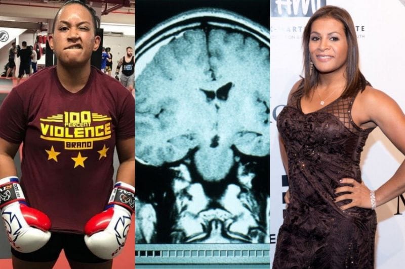 When transgender fighter Fallon Fox broke her opponent's skull in MMA fight