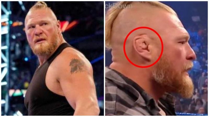 What happened to Brock Lesnar's ear?