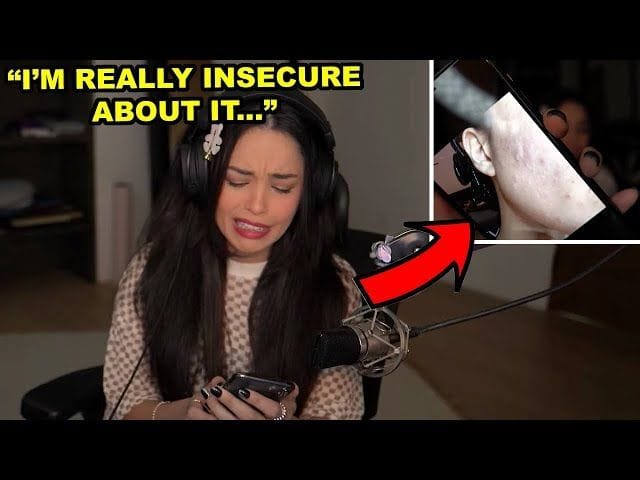 Valkyrae opens up to her fans about the skin problems she faces regularly