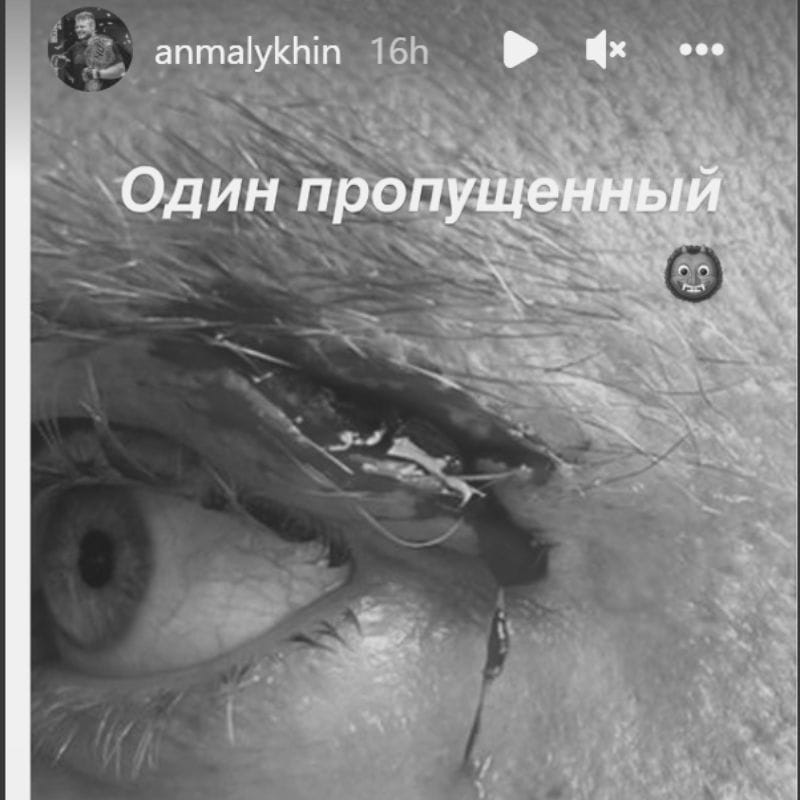 ONE interim heavyweight champion Anatoly Malykhin posts photo of a ...