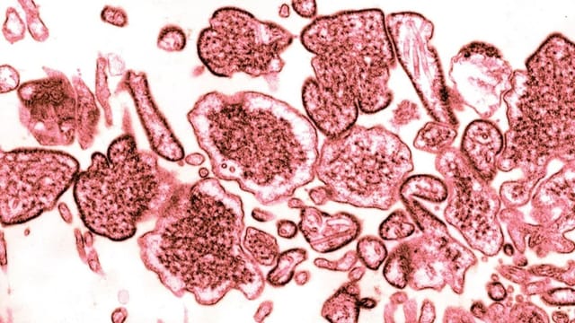How deadly is Langya virus? Symptoms and causes explored as China ...