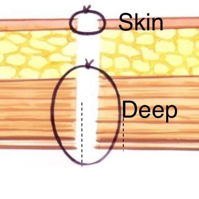 Dr. David Abbasi explains how ringside doctors excellently stitched up ...