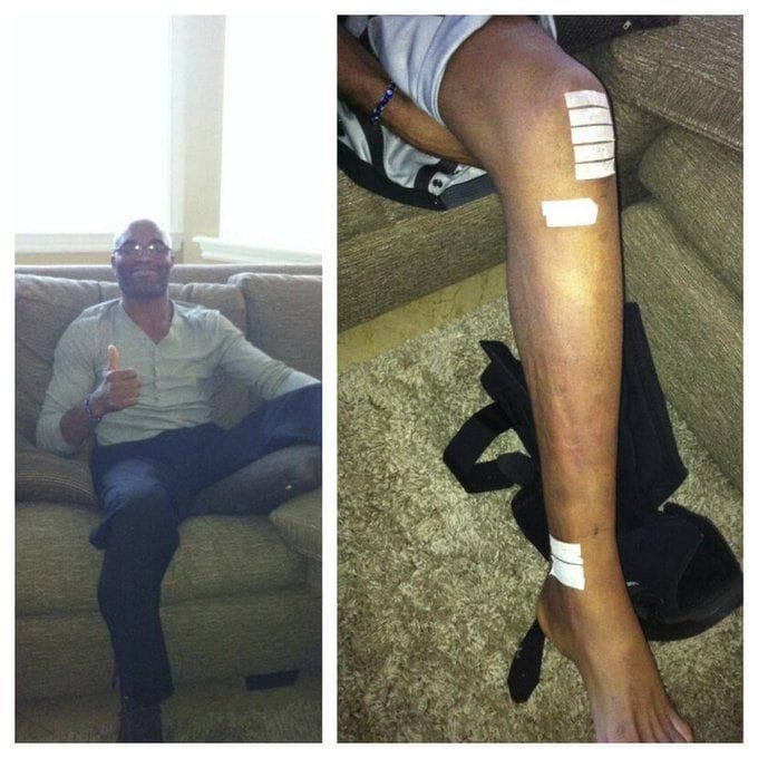 MMA stars who made miraculous recoveries from career-ending injuries