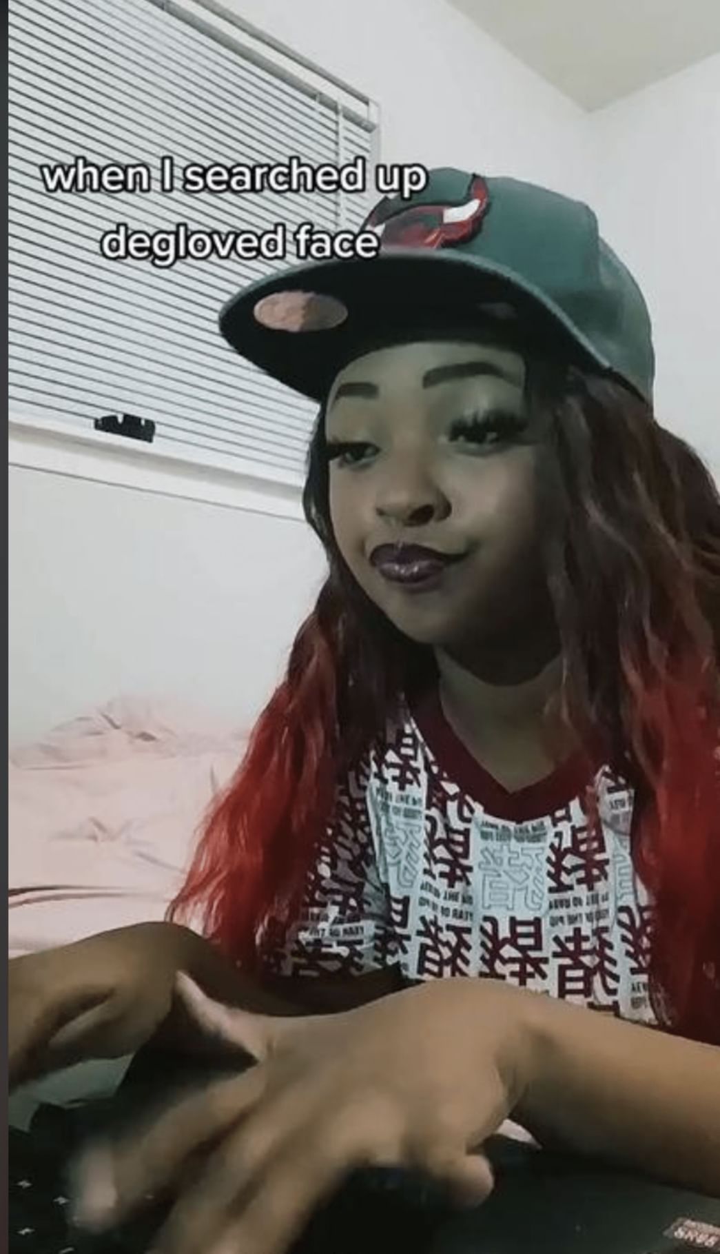 What is a degloved face? TikTokers urge netizens not to google the phrase