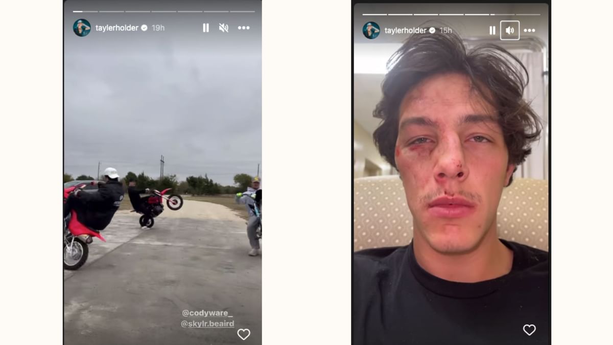 What happened to Tayler Holder? Influencer sustains broken nose ...