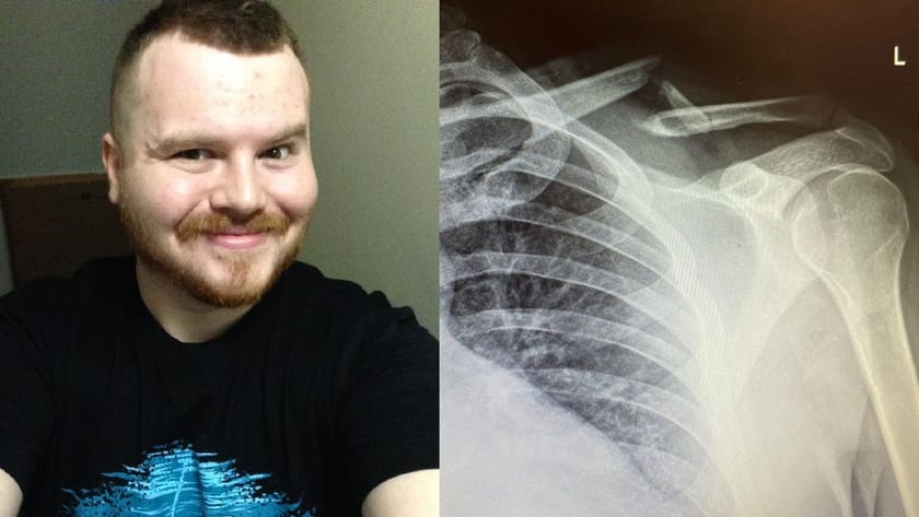 RuneScape streamer breaks collarbone on Twitch stream while riding bike