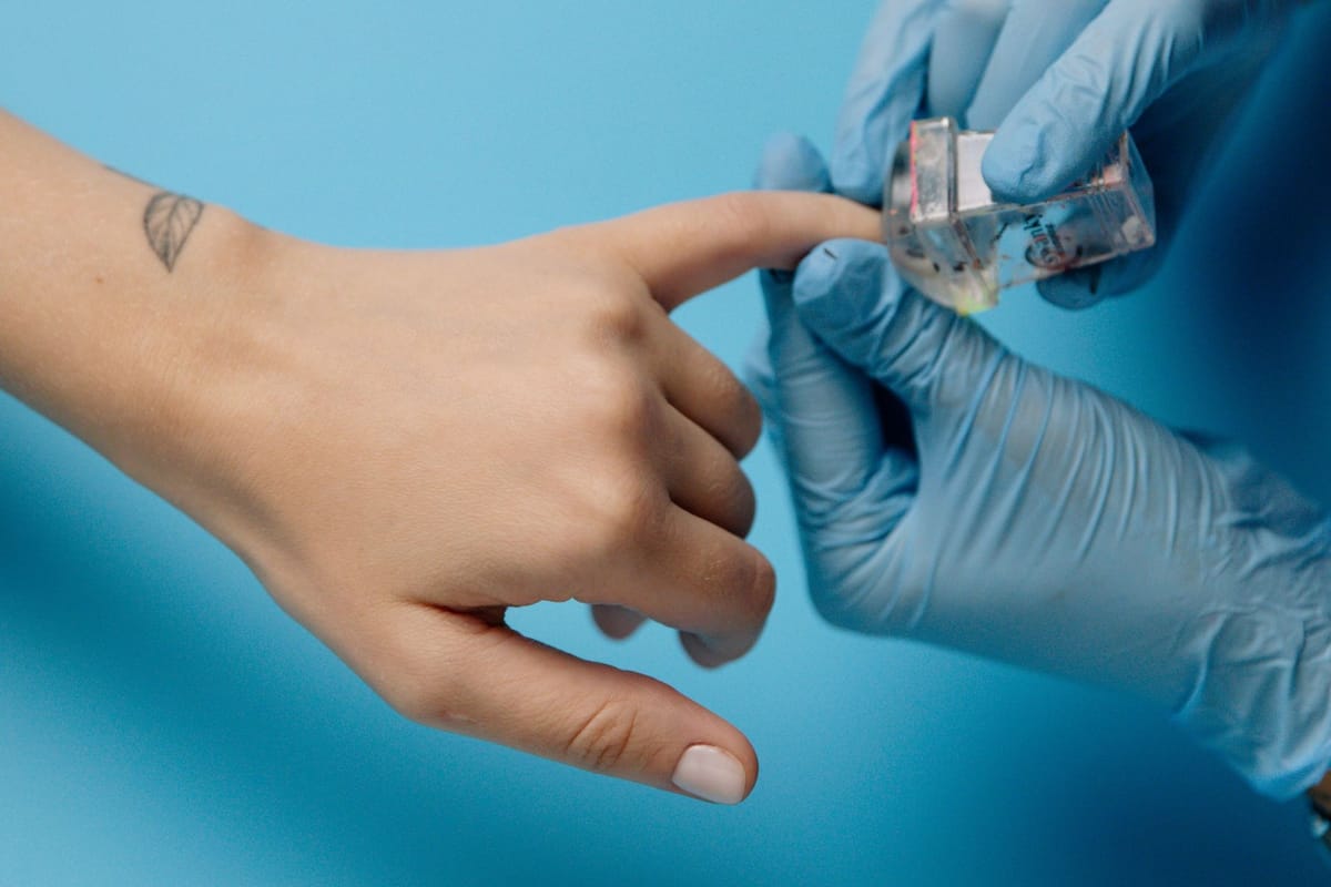 Koilonychia (Spoon Nails): What It Is, Signs, and More