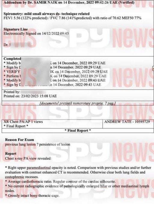 Andrew Tate: BREAKING: Andrew Tate may have lung cancer, alleged ...