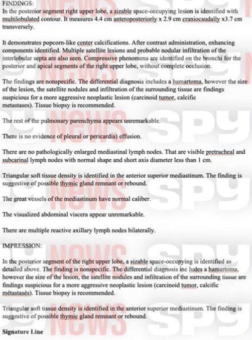 Lung Cancer: Andrew Tate's manager confirms 'Cobra' Tate is suffering ...