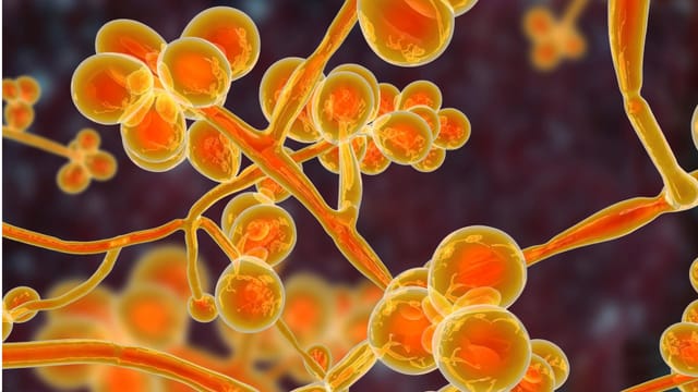 What is Candida auris? Symptoms explored as CDC issues warning about ...