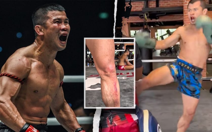 ONE Fight Night 9: Nong-O Hama wears battle scars from training with pride