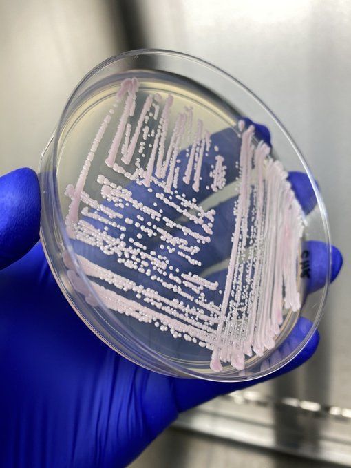 What is Candida auris? Symptoms explored as CDC issues warning about ...