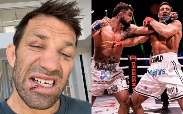 BKFC 41: WATCH: Luke Rockhold shows off broken tooth and stitched-up ...