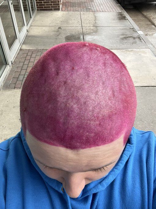 Twitch streamer shaves his head during subathon only for the top ...