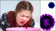 How Long Does Norovirus Last Incubation Period Explored Amid Recent