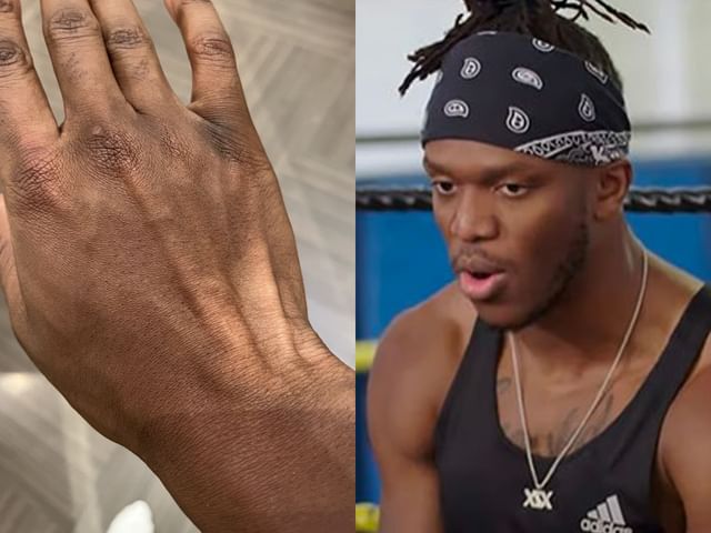"I'm turning white" - KSI responds to fans expressing concerns about ...