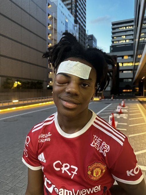 Is IShowSpeed okay? Streamer undergoes emergency surgery in hospital ...