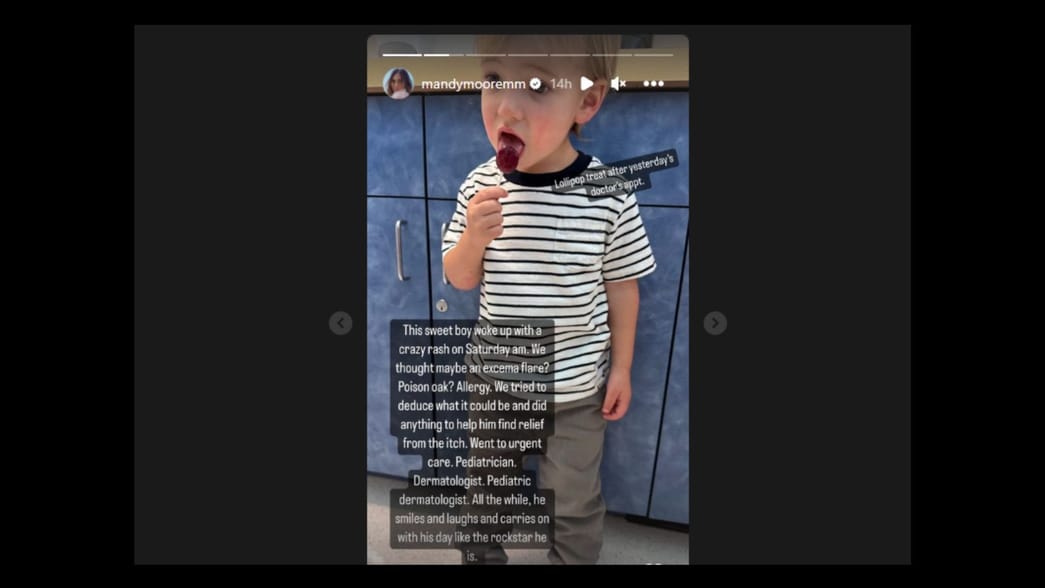 What is Gianotti-Crosti syndrome? Mandy Moore reveals son struggles ...