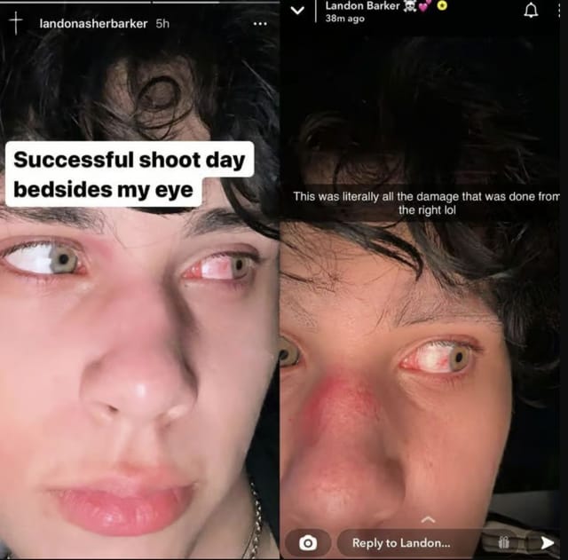 Who fought Landon Barker? Netizens react as influencer spars with ...