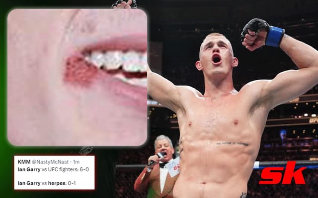 Does Ian Garry have herpes? Mouth scar triggers fan speculations during ...