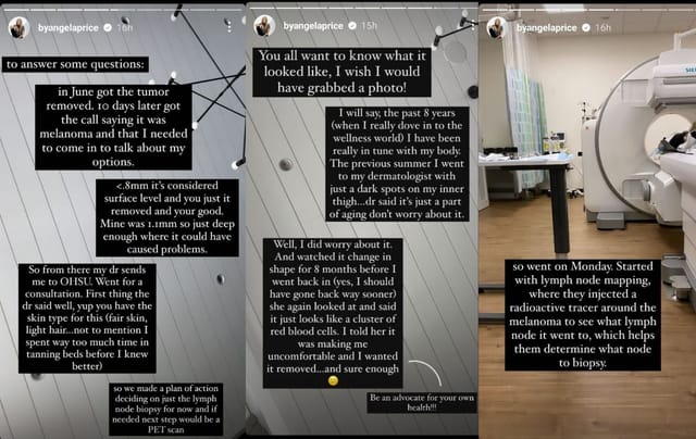 Carey Price's wife Angela shares her encounter with a potentially life ...