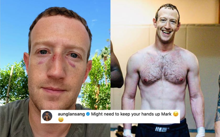 "Might need to keep your hands up" - Mark Zuckerberg banged-up after ...