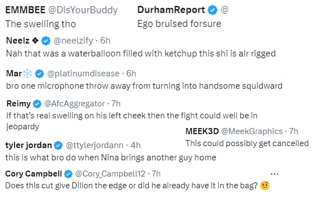 Logan Paul face injury: "The swelling tho" - Logan Paul shocks fans ...