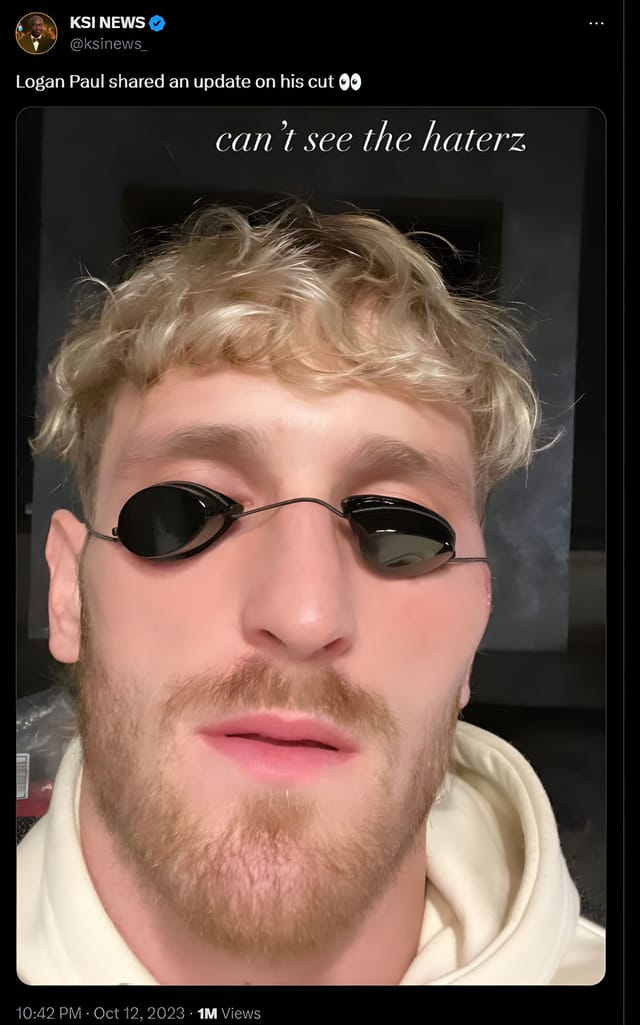 Logan Paul face injury: "The swelling tho" - Logan Paul shocks fans ...