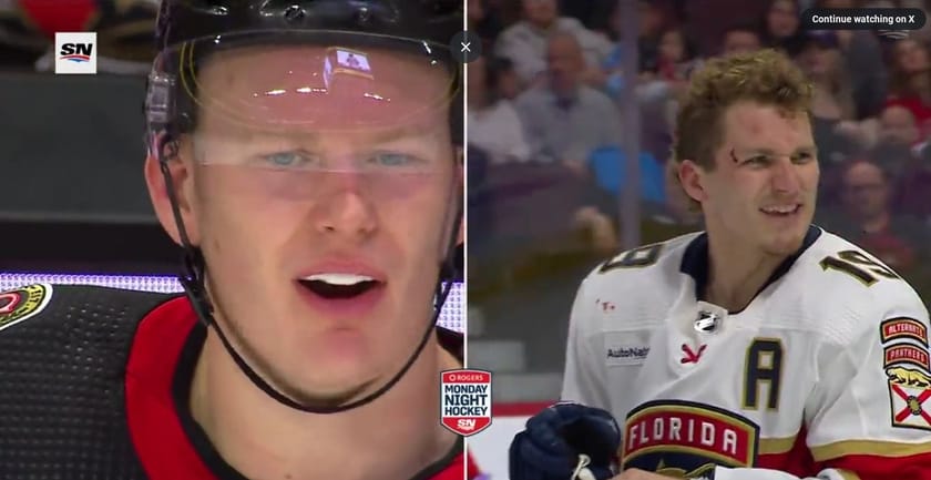 VIDEO: Matthew Tkachuk left bleeding after spirited fight with Jake ...