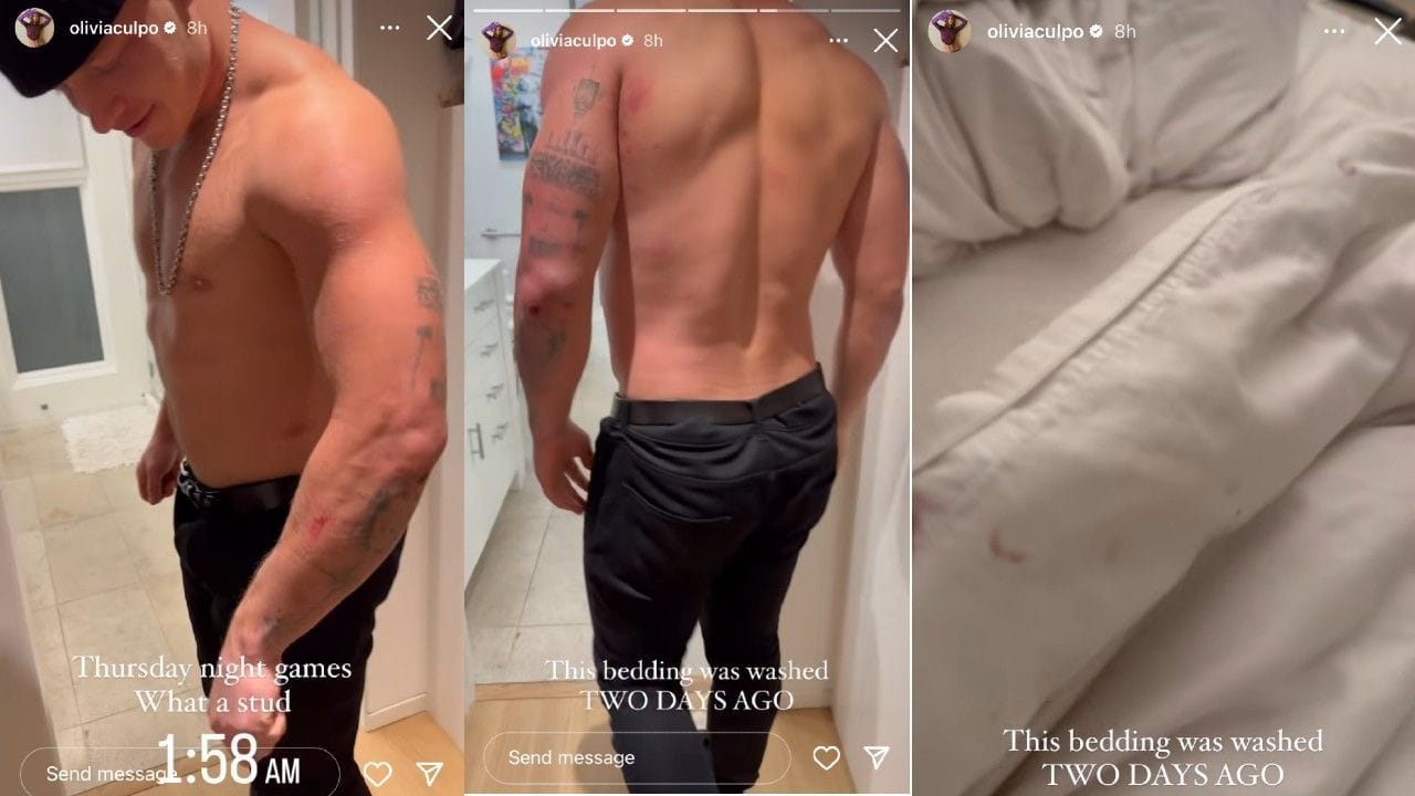 Christian McCaffrey's fiancée Olivia Culpo stunned over RB's bloody ...
