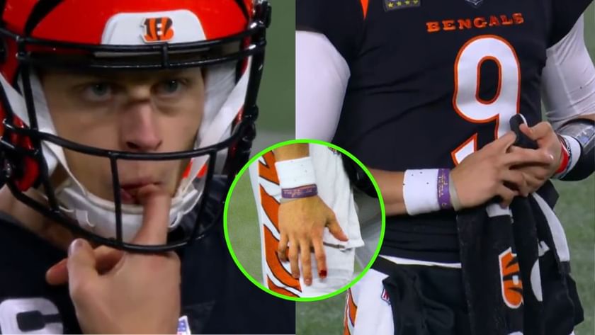 What happened to Joe Burrow's finger? Bengals QB suffers brutal injury ...