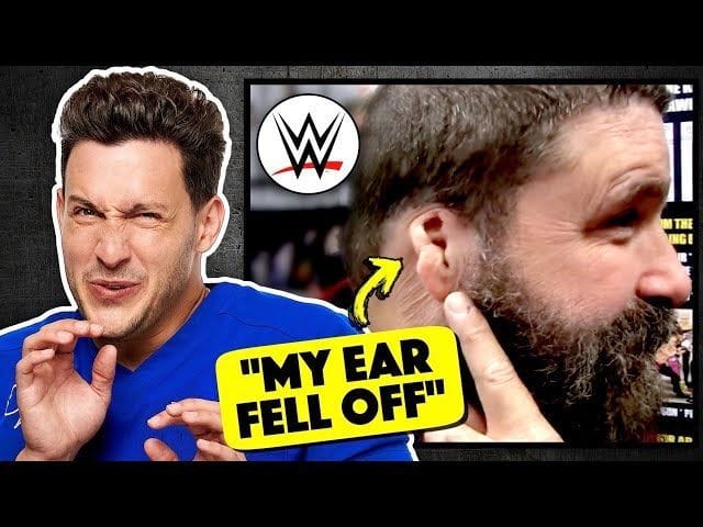 Why do Brock Lesnar and a few other WWE legends have cauliflower ears?