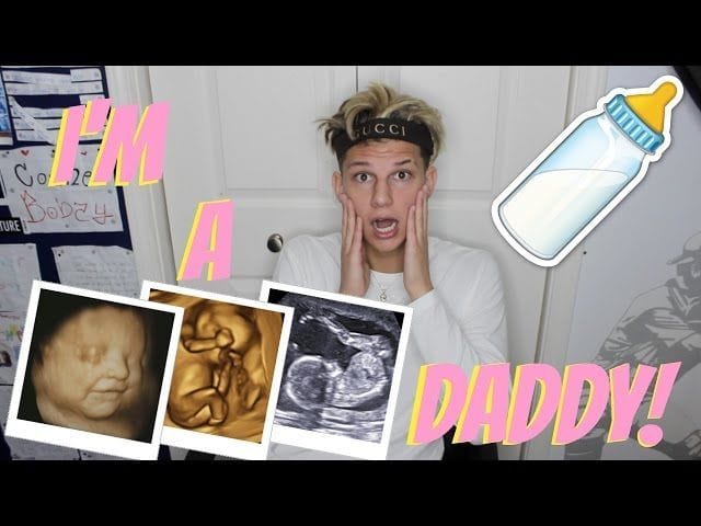 Conner Bobay's Profile, Net Worth, Age, Height, Relationships, FAQs