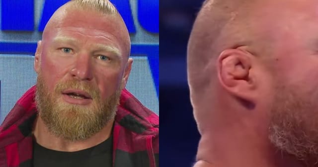 Why do Brock Lesnar and a few other WWE legends have cauliflower ears?