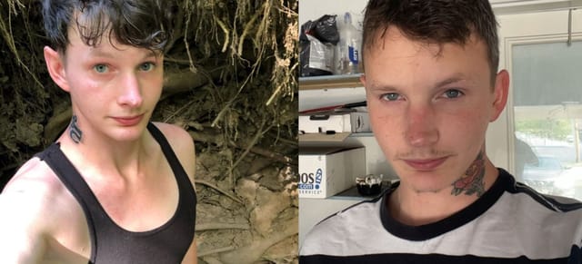 Sam Wilson reveals the truth behind His jaw and teeth