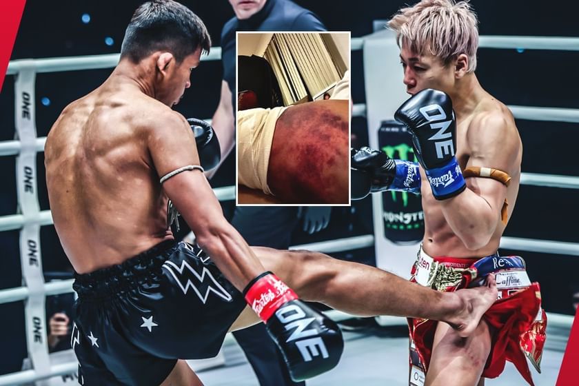 Takeru ONE 165: “Can’t even walk now” - Japanese icon Takeru reveals ...