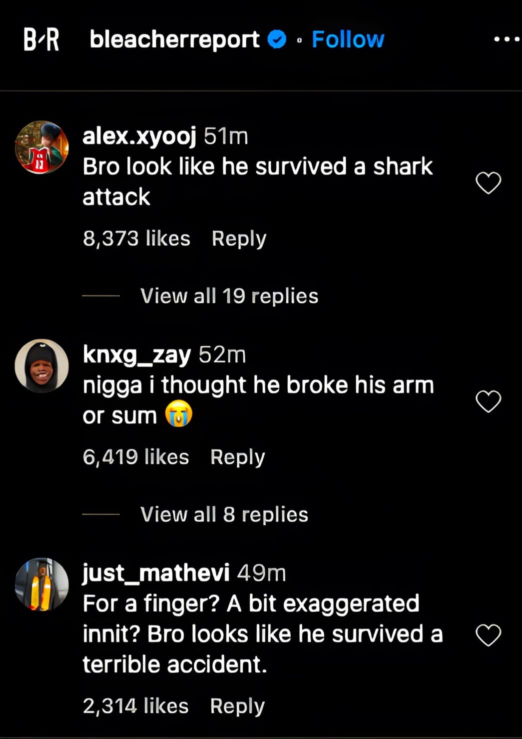 "They chopped his hand off" - Trae Young's recent post surgery images ...