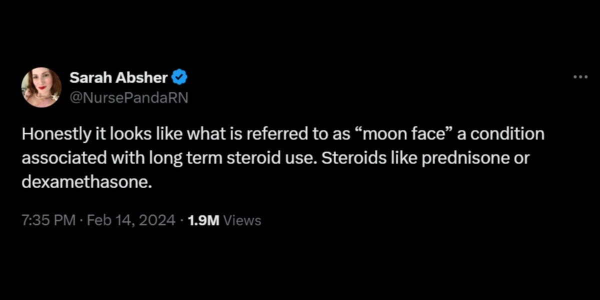 Amy Schumer: What is Prednisone Moon face? Internet defends Amy Schumer ...