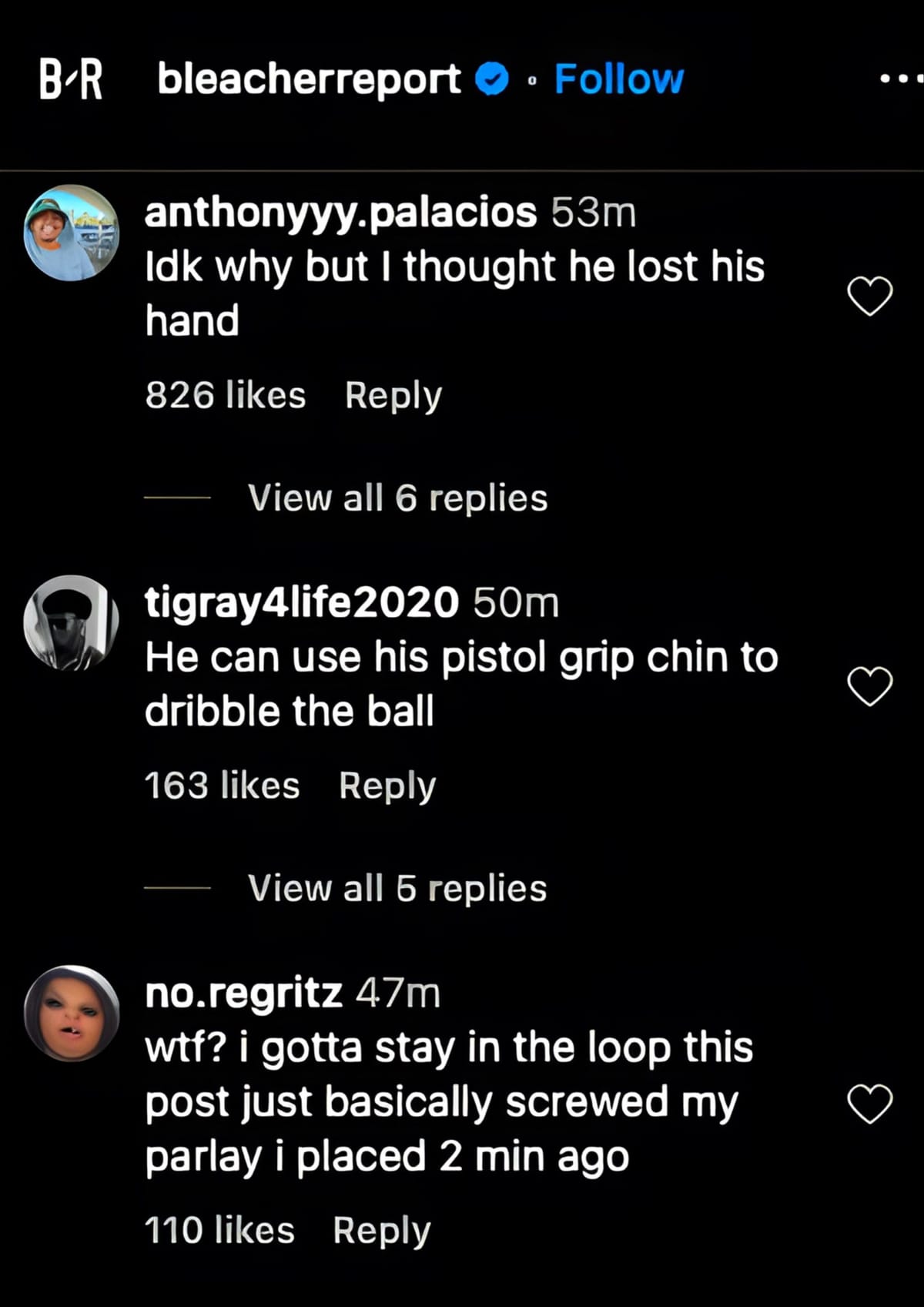 "They chopped his hand off" - Trae Young's recent post surgery images ...