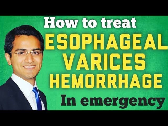 What is esophageal varices? All about Jonathan Crenshaw as the homeless ...