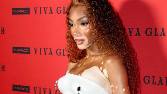 In Photos: Kyle Kuzma's girlfriend Winnie Harlow puts herself alongside ...