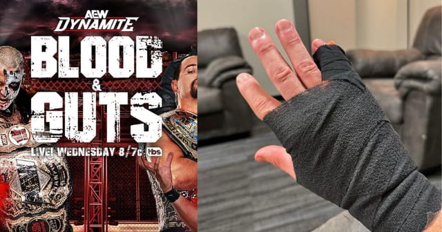 Top star suffers broken finger at AEW Blood & Guts