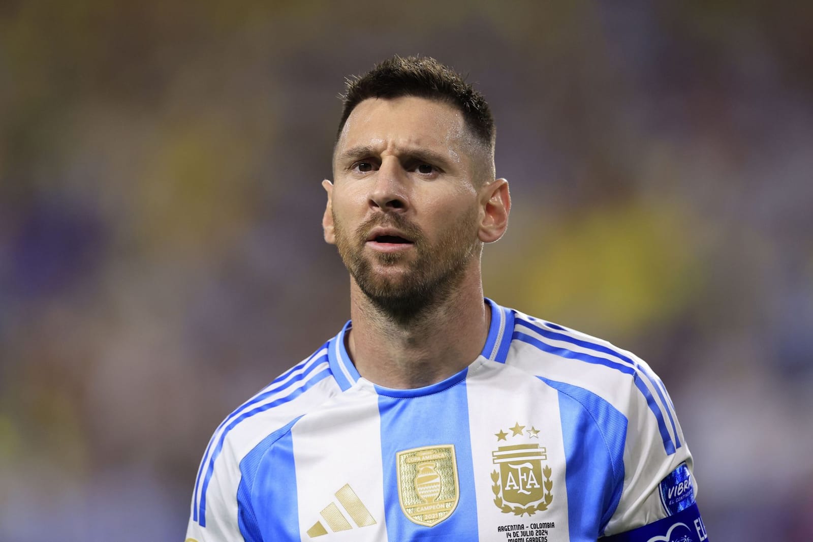 IN PHOTOS: Lionel Messi's ankle swells up like a tennis ball as he ...