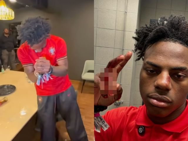 IShowSpeed shares image of his hand following recent injury on livestream