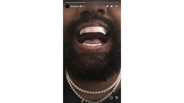 From Post Malone to Lil Yachty: Kanye West's dentist Thomas Connelly's ...