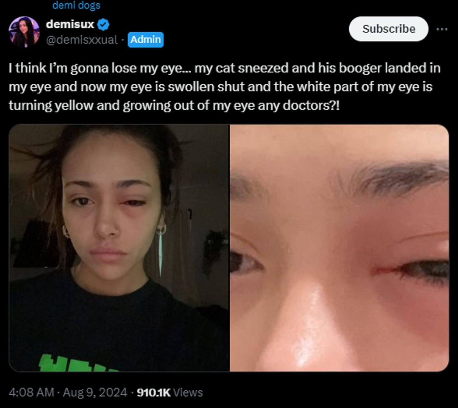 Kick streamer Demisux claims she could "lose her eye" following an ...