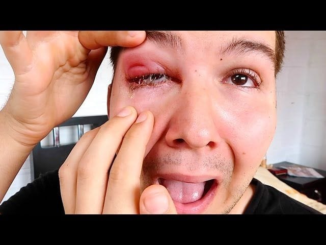 Who is Nikocado Avocado?