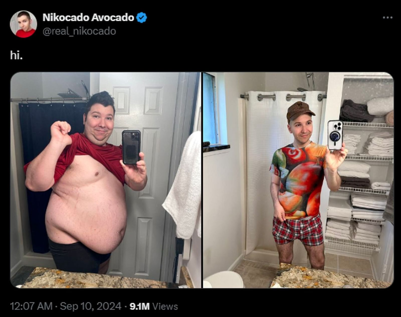 "Ozempic or not, that's a hell of a transformation" - Fans react as Nikocado Avocado shows ...