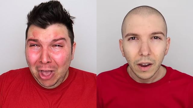 How did Nikocado Avocado lose weight? Possibilities explored